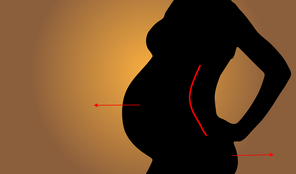 What I wish I had known about Pregnancy Posture! - Terramed Physio & Rehab